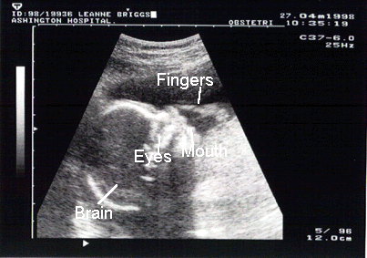 Scan photos